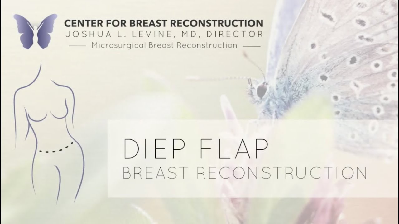 DIEP Flap Breast Reconstruction - Guided Illustration - By Dr. Joshua L. Levine