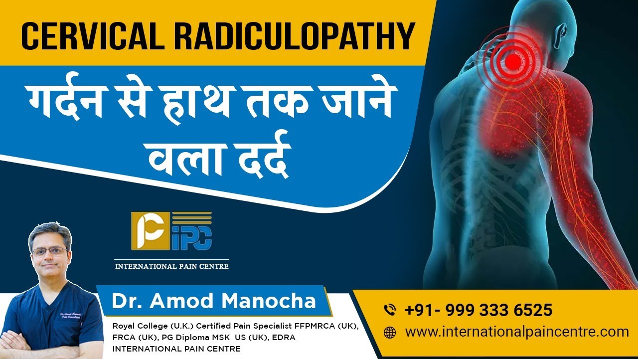 Understanding Cervical Radiculopathy: Symptoms, Causes, and Treatment ...