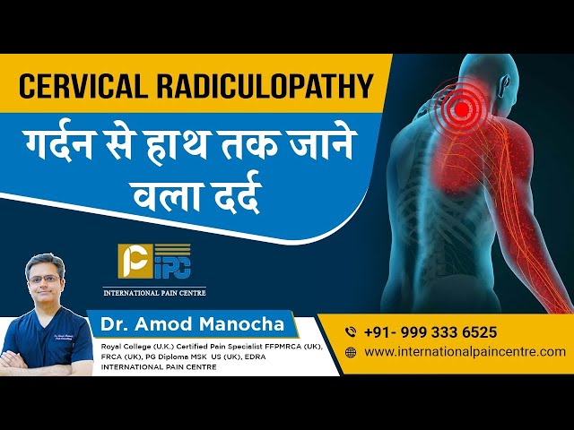 Understanding Cervical Radiculopathy: Symptoms, Causes, and Treatment Options | Galaxy.ai ...