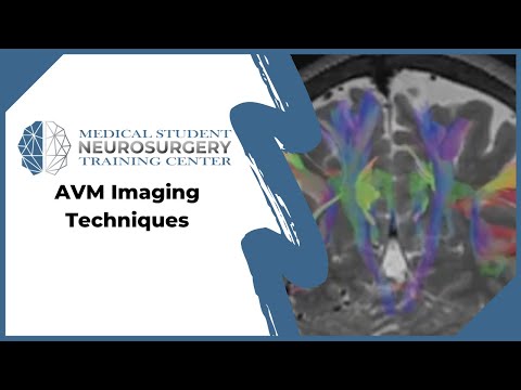 AVM Imaging Techniques