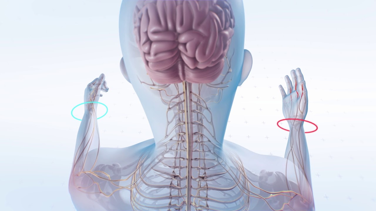 What is Multiple Sclerosis? An Overview of MS Causes, Symptoms, Treatments & Research
