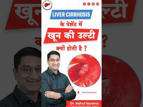 Why does a liver cirrhosis patient vomit blood? | Dr. Rahul Saxena | #livercirrhosis #liverpool