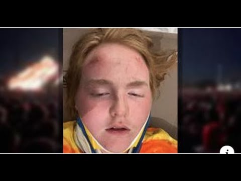 Teen from Stark County Injured At Astroworld festival,video footage of chaos