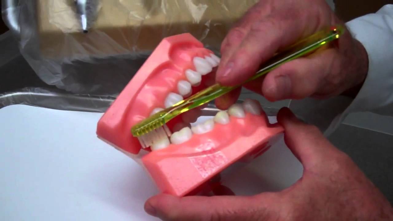 Brushing Technique - Oral Hygiene Instructions by Dr. Berdy, periodontist Jacksonville, FL