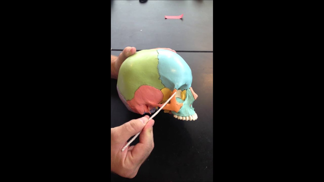 Zygomatic Bone