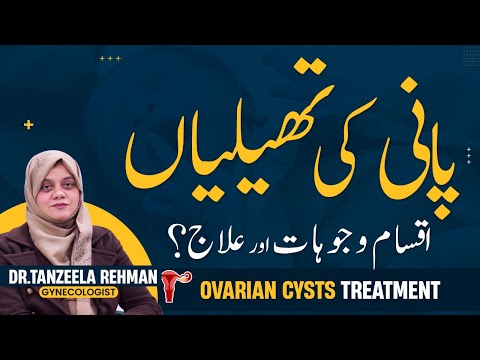 Pani Ki Thelion Ka Ilaj | Ovarian Cyst Causes & Treatment | Treatment Of Ovarian Cyst In Urdu