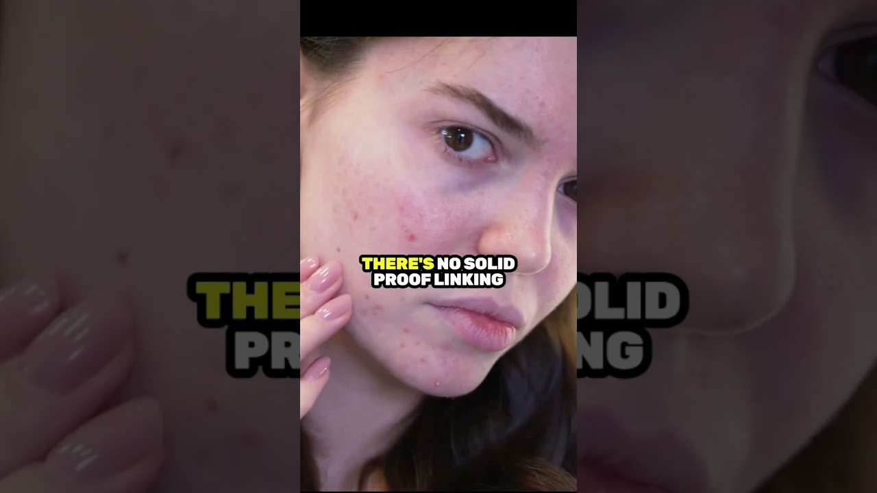 🍫 Chocolate Gives You Pimples? #MythBusted #SkinFacts