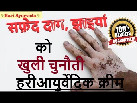 Vitiligo Cream - Ayurvedic Vitiligo Leucoderma Cream Manufacturer from ...