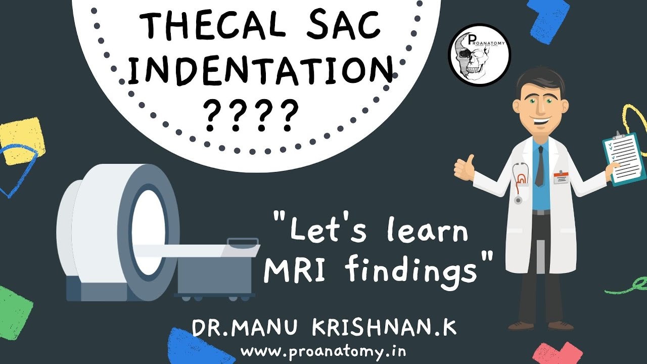 What is Thecal Sac indentation ? Learn to read MRI