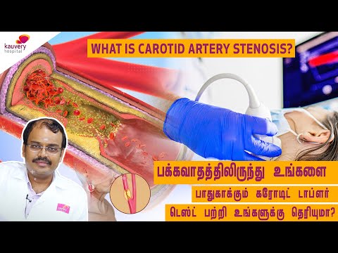 What is carotid artery stenosis?