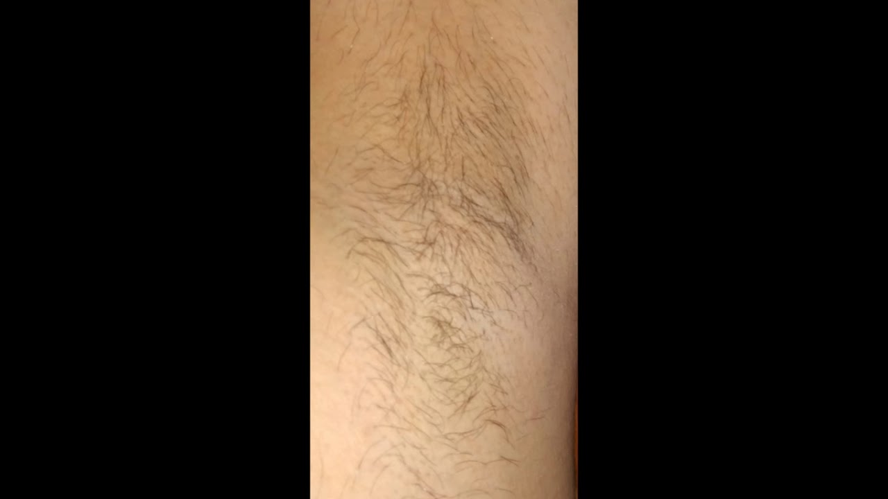 Armpit hair growth in 30 days (timelapse)