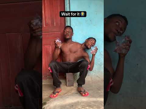 Conjoined twins #youtubeshort