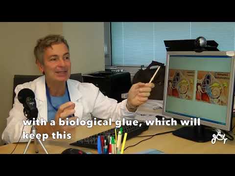 A new surgical technique for the treatment of Meniere’s disease.