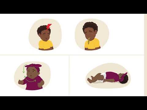Tuberculosis: How to assess a child for TB