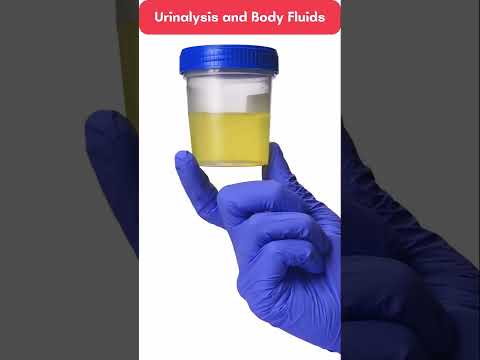What are these Casts in Urine? #urinalysis #castsinurine #casturine