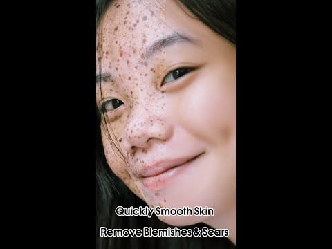 Photoshop Tutorial: How to Quickly Smooth Skin and Remove Blemishes & Scars | Sk Graphics Home
