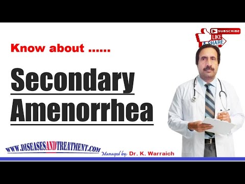 Secondary Amenorrhea : Causes, Diagnosis, Symptoms, Treatment, Prognosis
