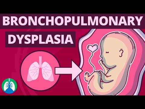Bronchopulmonary Dysplasia (BPD) | Medical Definition and Explainer Video