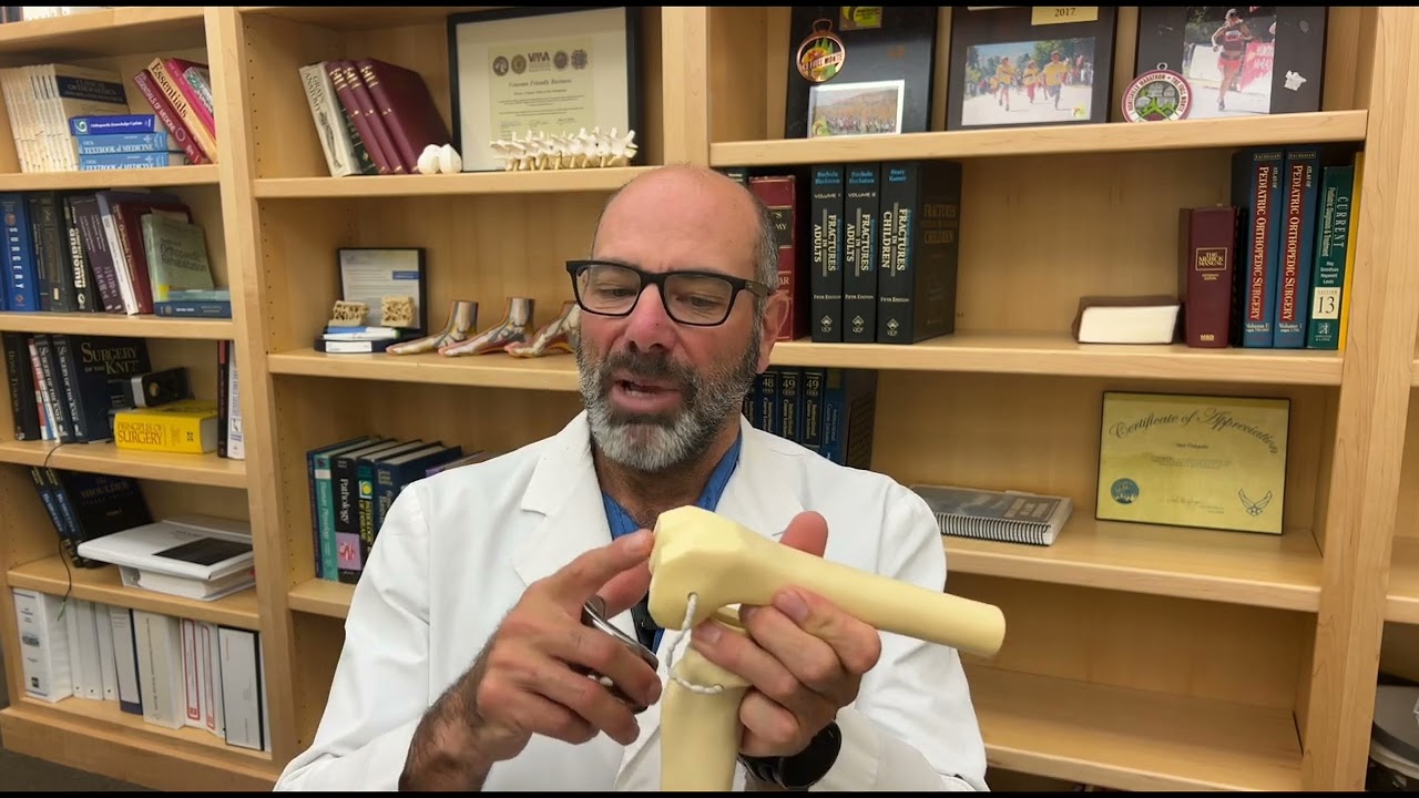 Kinematic Alignment Total Knee