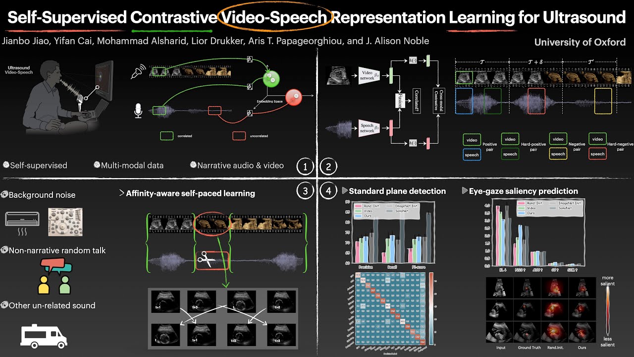 Self-Supervised Contrastive Video-Speech Representation Learning for Ultrasound