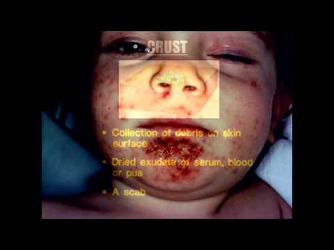 Cutaneous Manifestations of Systemic Disease by Dr. Kevin T. Belasco