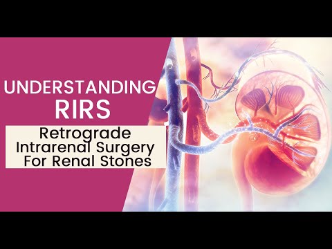 Understanding RIRS - Retrograde Intrarenal Surgery For Renal Stones