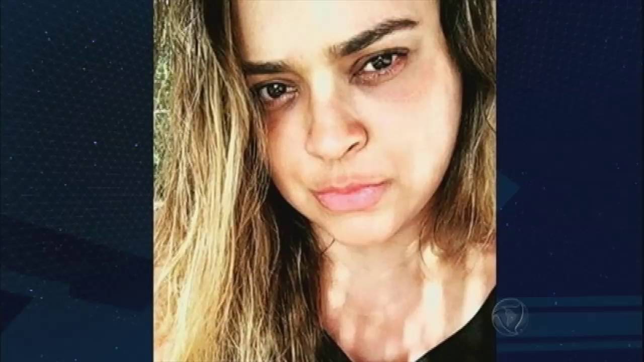 Conheça novidades para o tratamento das temíveis olheiras