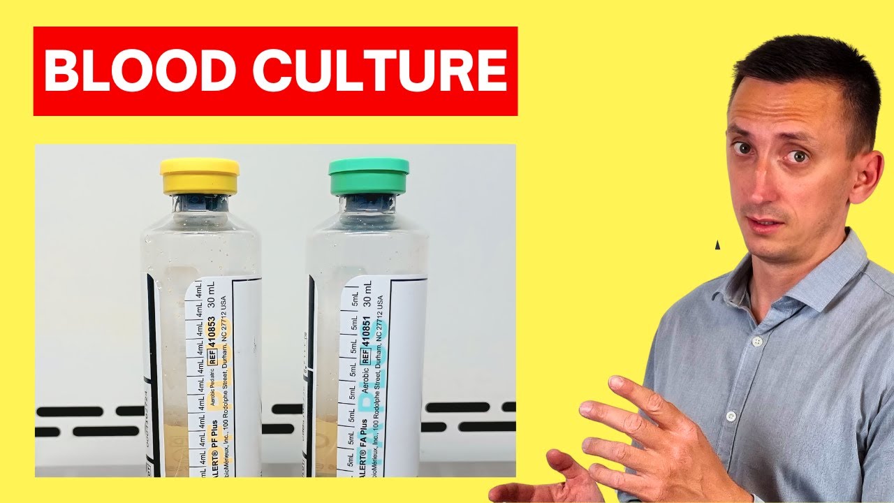 Blood Cultures: Everything Clinicians Need to Know