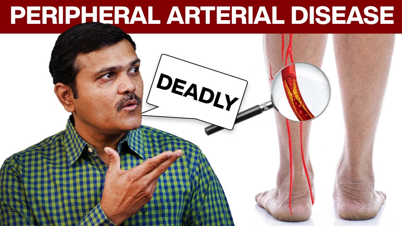 Understanding Peripheral Arterial Disease: Symptoms, Causes, and Treatment Options | Galaxy.ai