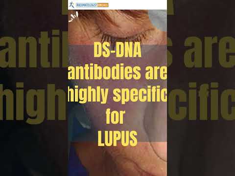 dsDNA test (double- stranded DNA test) - what does it mean?