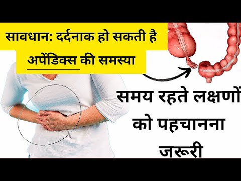 अपेंडिक्स क्या होता है? | What Are Symptoms of Appendicitis | Appendix In Hindi