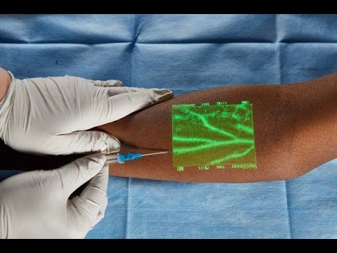 VeinViewer Flex ® is Now in Egypt !