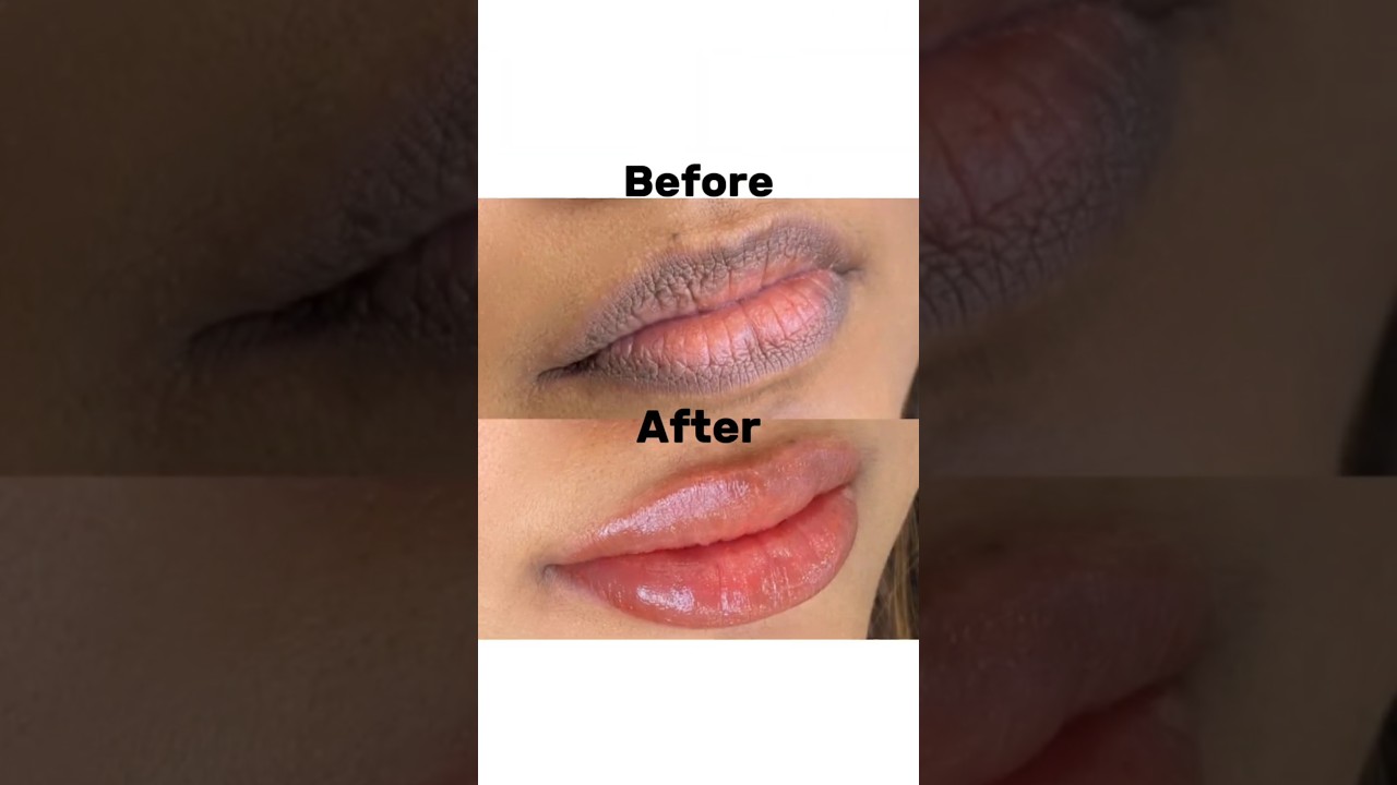 Get Soft, Pink Lips Naturally | Easy Home Remedy 🌸 #darklips #softlipsgirls