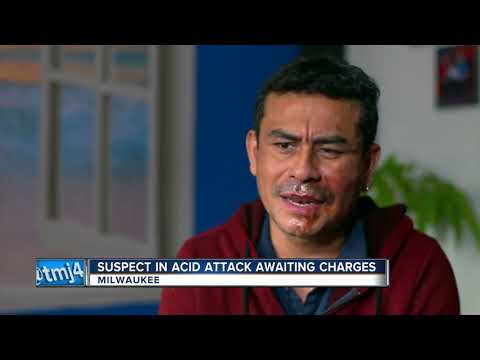 Acid Attack suspect awaits charges