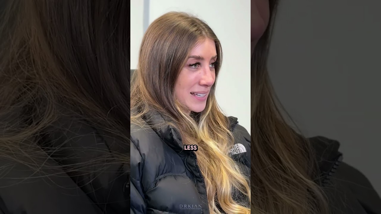 Charlotte's Primary & Revision Rhinoplasty Journey with Dr. Kian