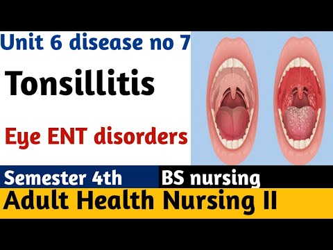 Tonsillitis - causes (viral, bacterial), pathophysiology, treatment, tonsillectomy Urdu and English