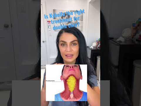 Kybella for double chin treatment is not for everybody!!! Are you a good candidate?