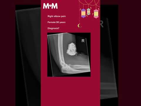 What is the the diagnosis,#shorts part (1)