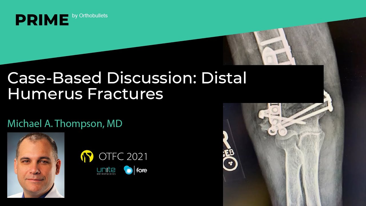 Distal Humerus Fractures - Michael Thompson, MD