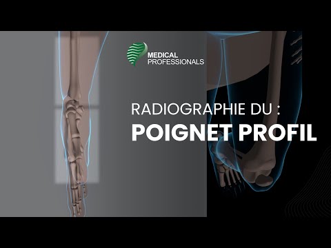 Incidences : Radiographie du POIGNET PROFIL