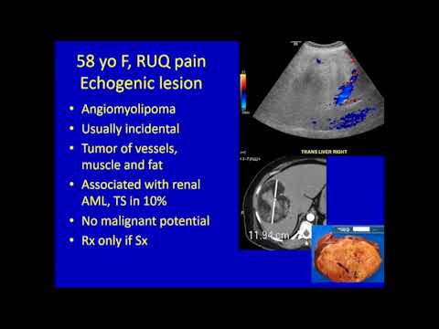 Liver Lesions