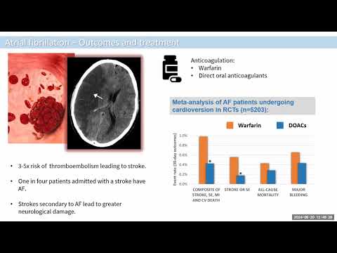 Atrial Fibrillation (AF) and the association with Vascular Dementia