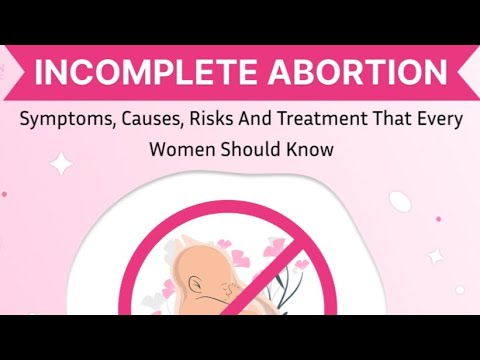 Incomplete Abortion: Causes, Symptoms, and Treatment Explained