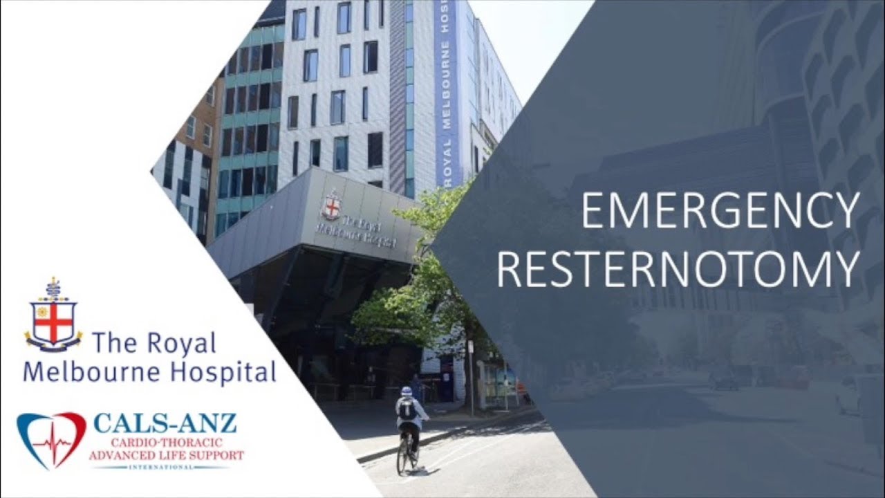 CALS Resternotomy VF Arrest