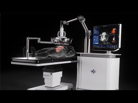 Histotripsy: Dignity Health Arizona's Latest Medical Advance Technology