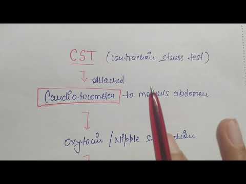CST(contraction stress test)