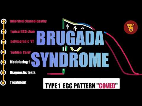 Brugada Syndrome EXPLAINED: Genetics, ECG Patterns & ESC 2022 Guidelines (USMLE High-Yield)
