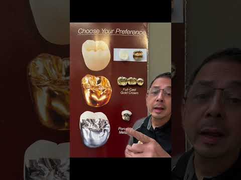 Dentist Explains: Different Types of Dental Crowns | View Mobile Dental