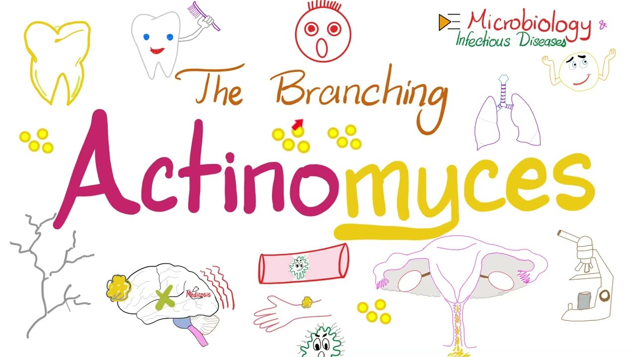 Actinomyces israeli - Branching Bacteria - Microbiology & Infectious Diseases