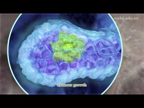 The Origin of Breast Cancer